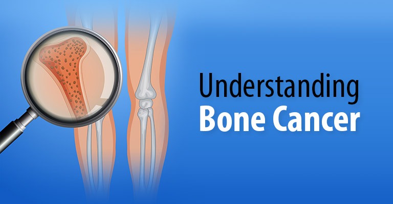 Treatment of Bone Cancer and its various symptoms by Pritish
